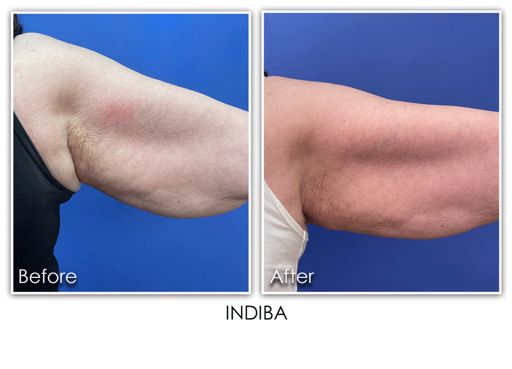 Galleries Archive - Page 2 of 22 - Skin Rejuvenation Clinic Skin ...