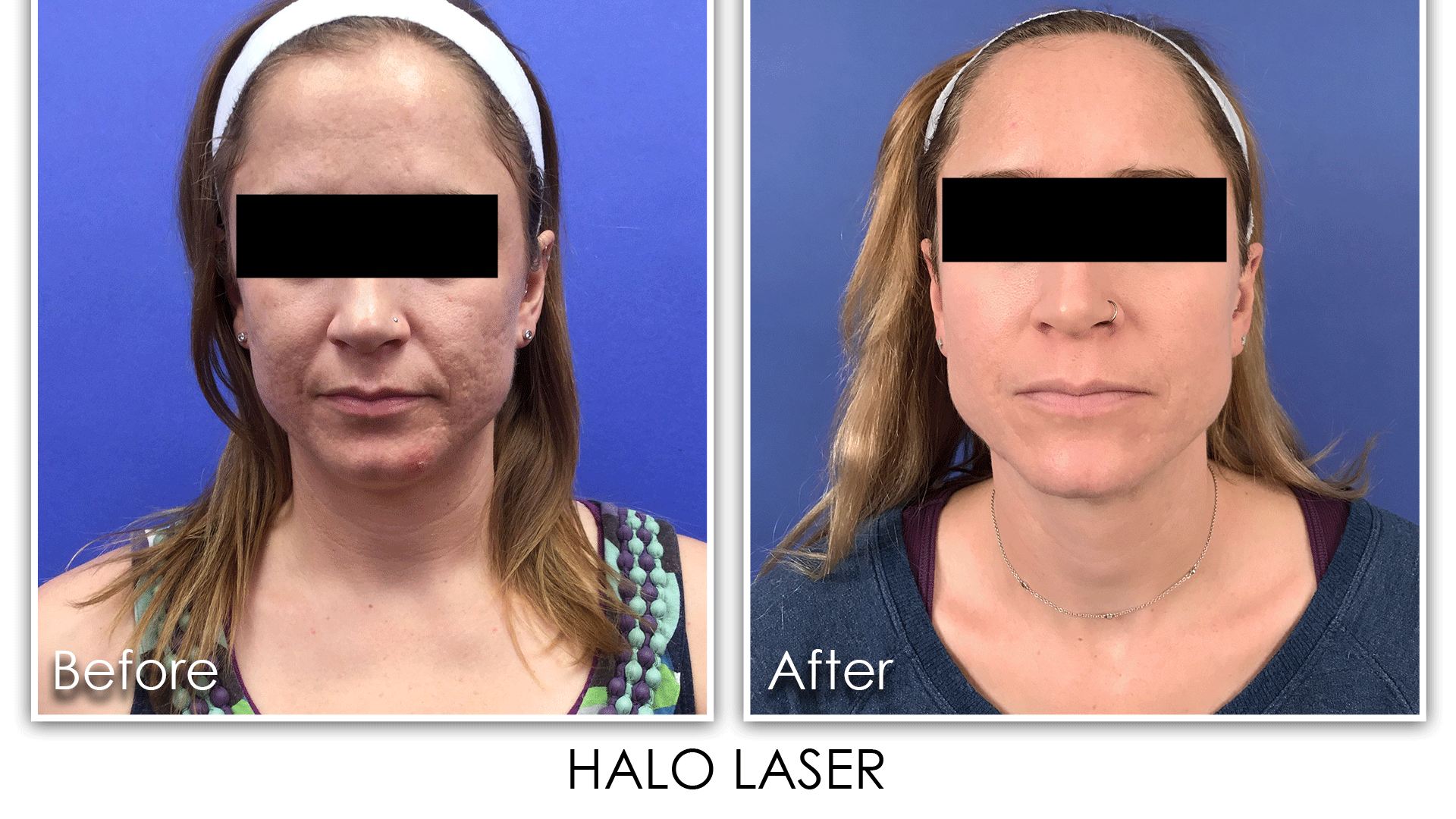 12 HALO - Skin Rejuvenation Clinic Skin Rejuvenation Clinic 12 HALO - Skin Rejuvenation Clinic Skin Rejuvenation Clinic