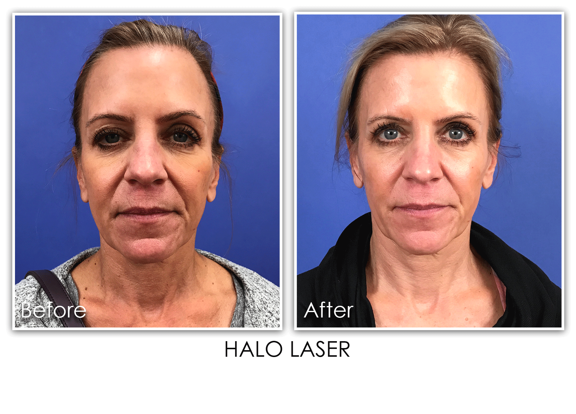 3 HALO - Skin Rejuvenation Clinic Skin Rejuvenation Clinic 3 HALO - Skin Rejuvenation Clinic Skin Rejuvenation Clinic