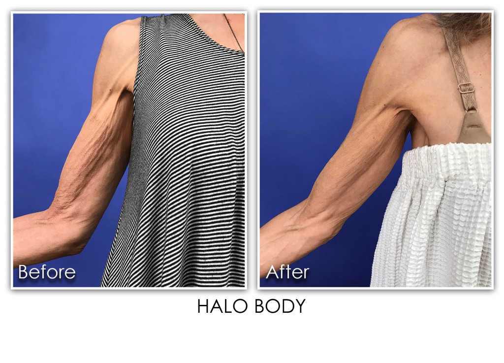 Halo Body - Skin Rejuvenation Clinic Skin Rejuvenation Clinic