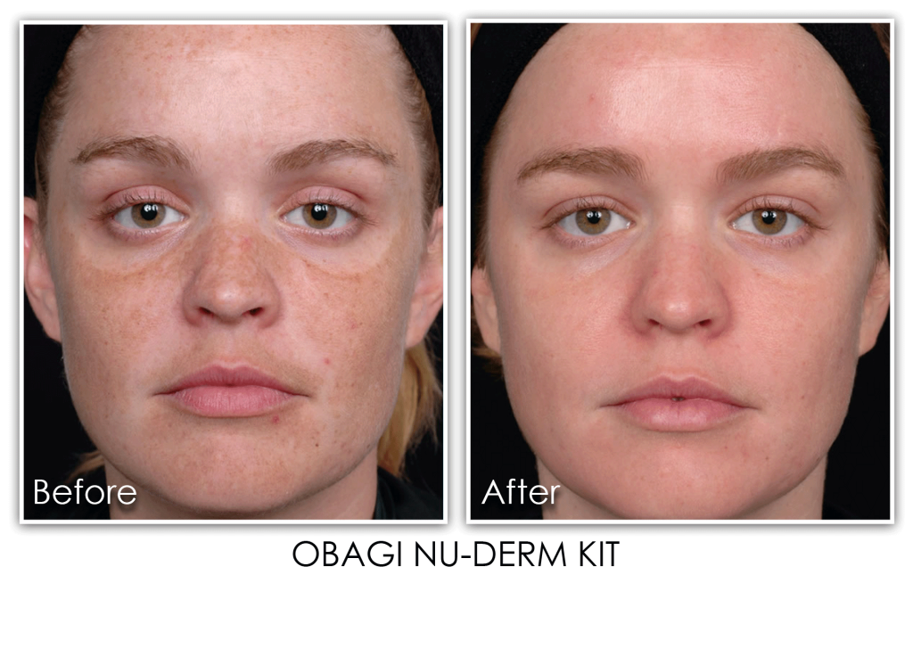 Obagi Nu-Derm Archives - Skin Rejuvenation Clinic Skin Rejuvenation Clinic