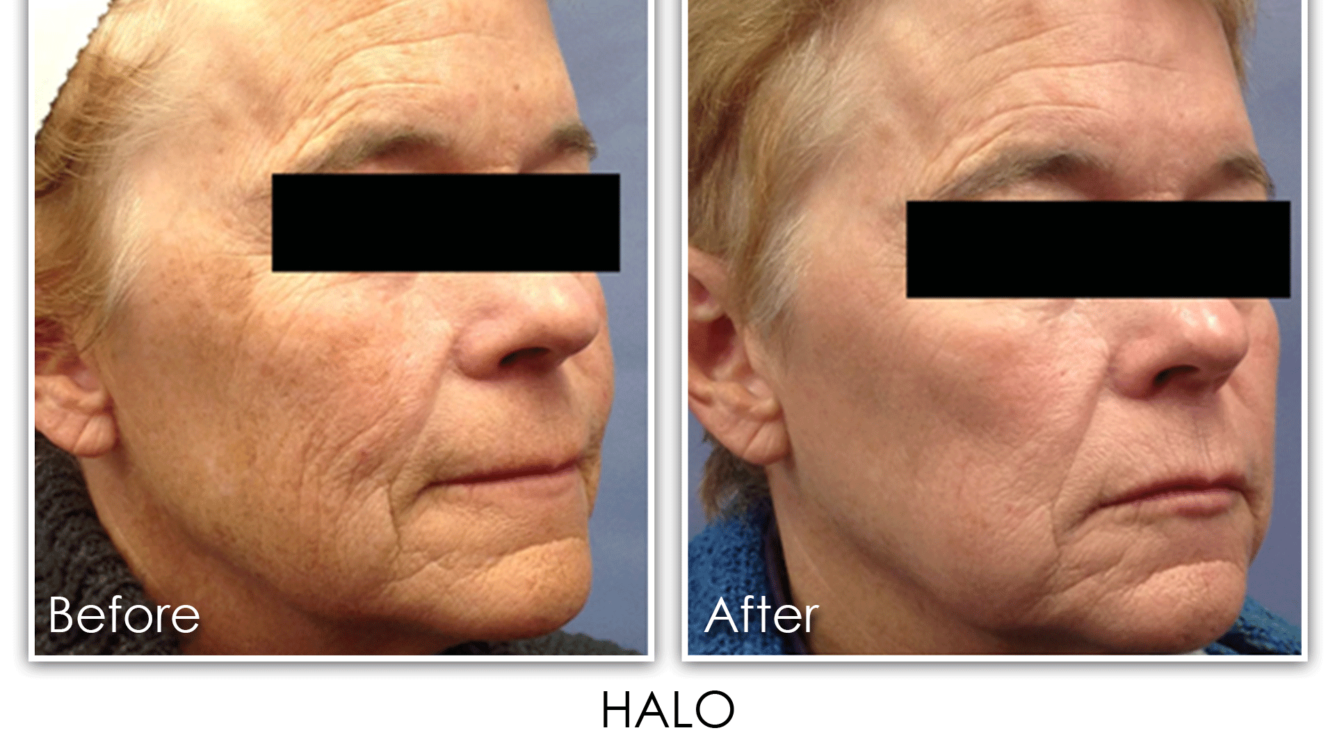 25 HALO - Skin Rejuvenation Clinic Skin Rejuvenation Clinic