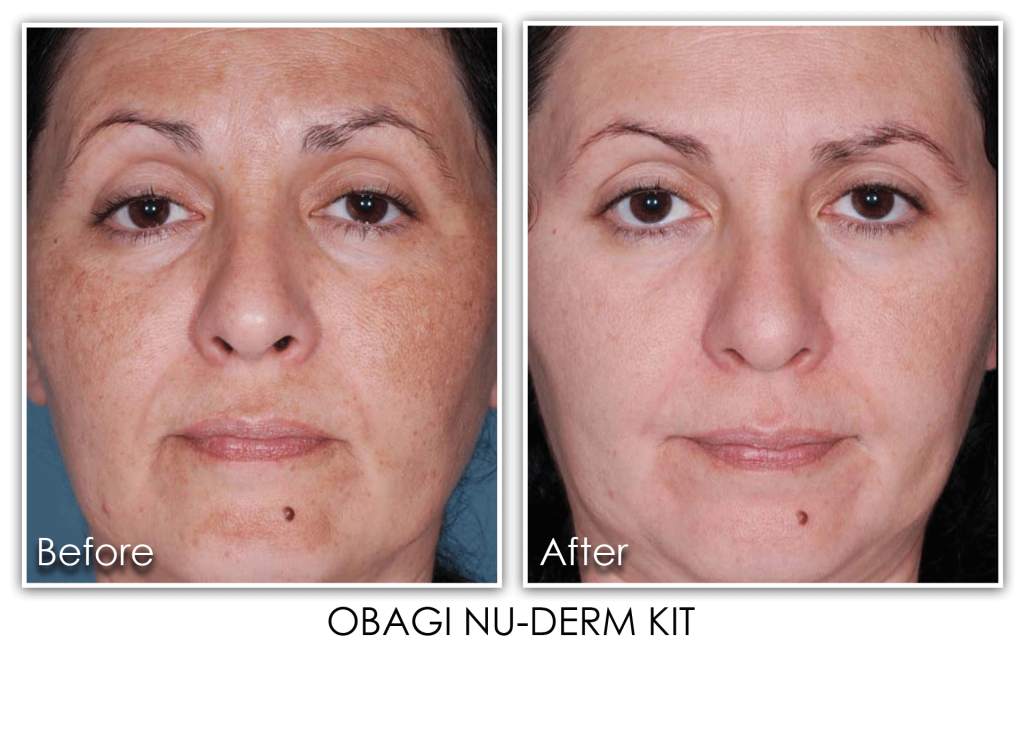Galleries Archive Page 18 Of 22 Skin Rejuvenation Clinic Skin