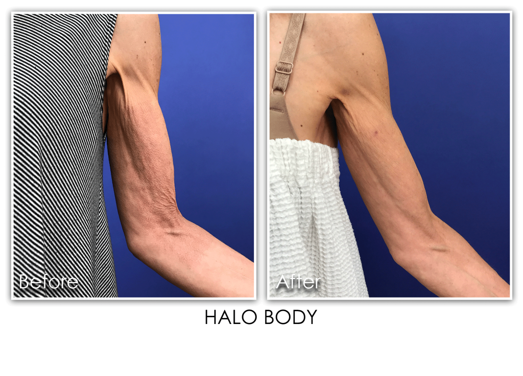 Halo Body - Skin Rejuvenation Clinic Skin Rejuvenation Clinic