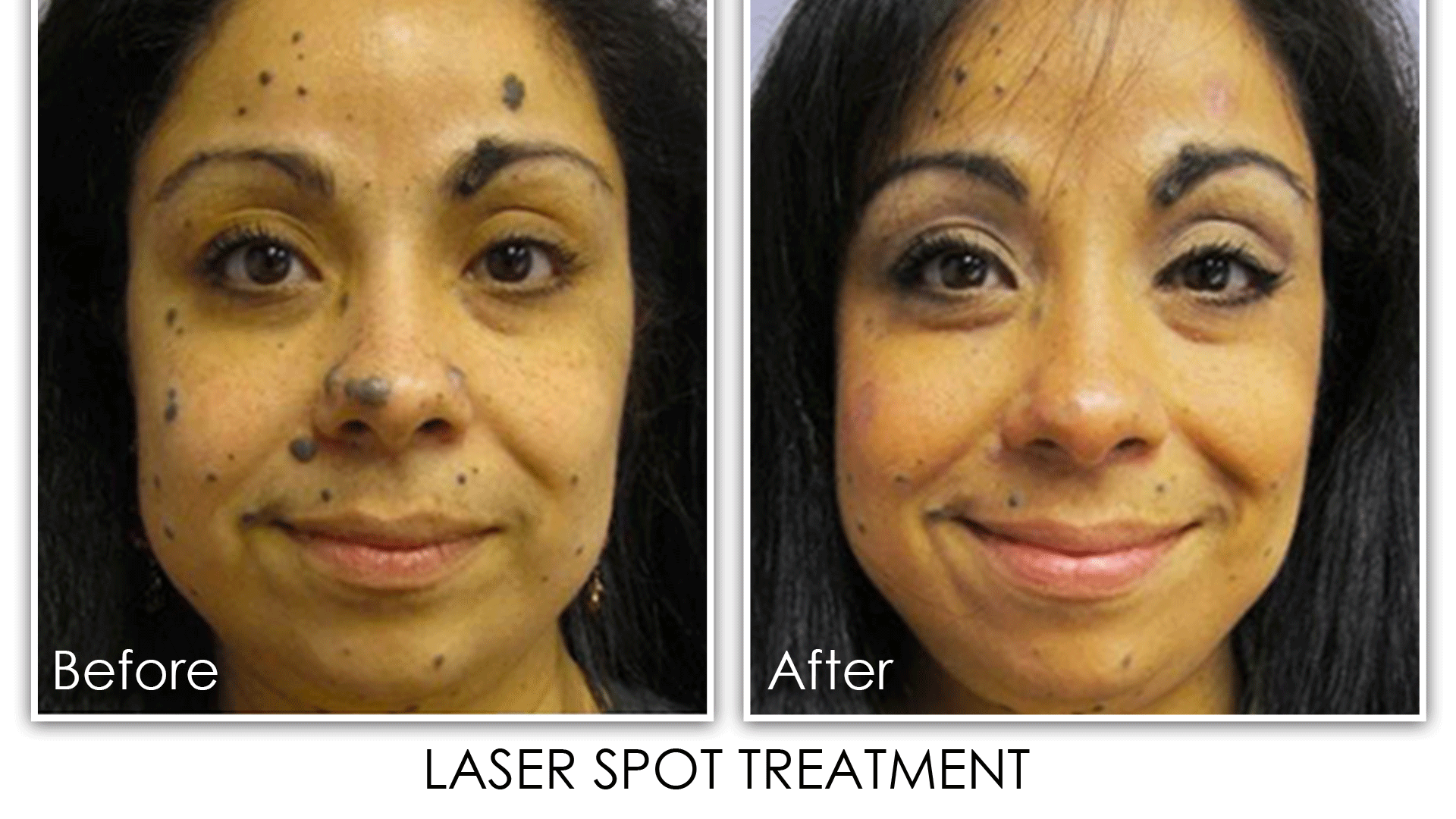 8 MLP - Skin Rejuvenation Clinic Skin Rejuvenation Clinic