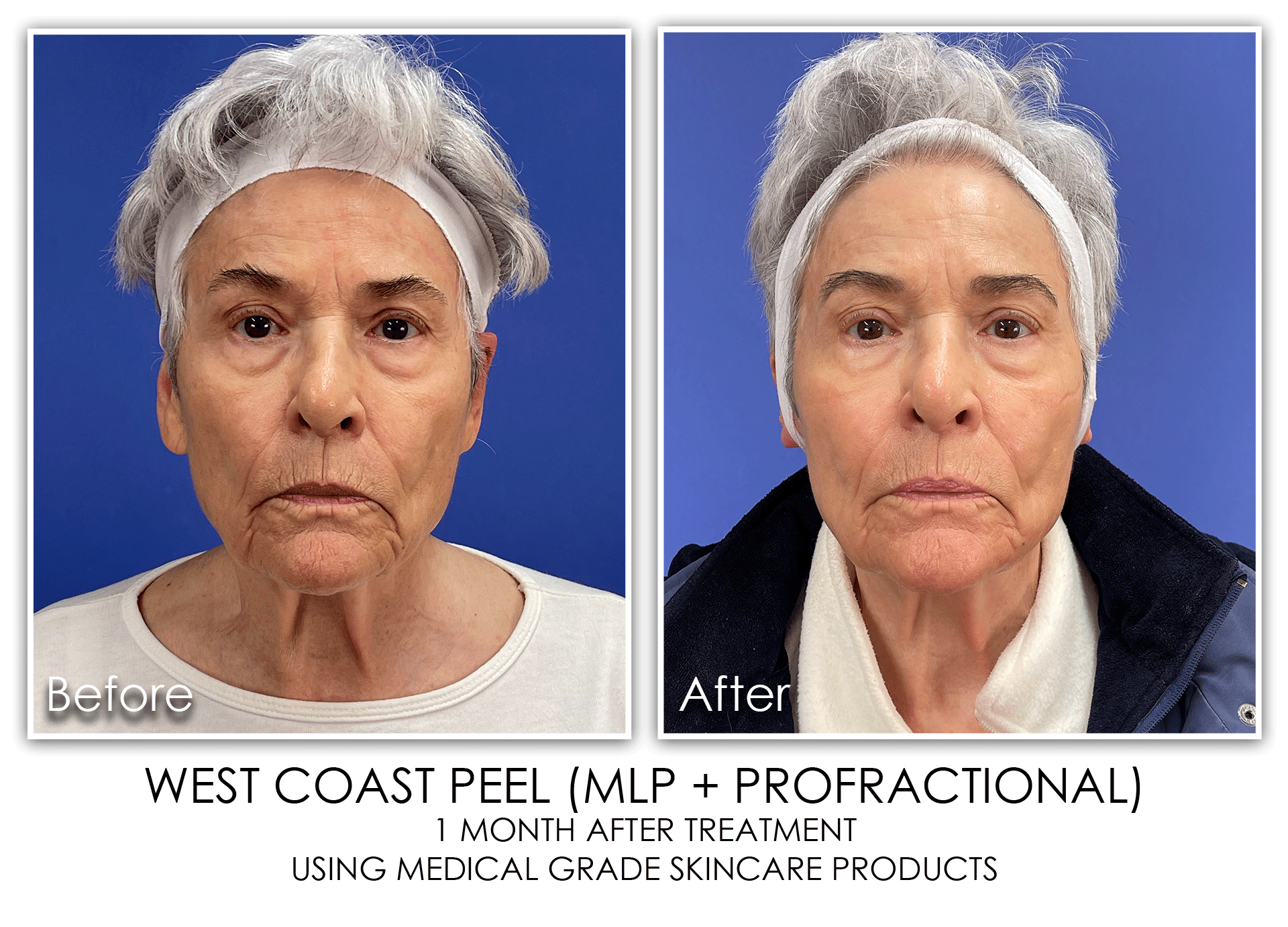 8 Combination Laser Skin Rejuvenation Clinic Skin Rejuvenation Clinic