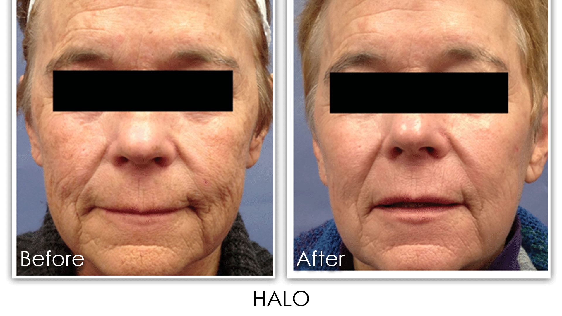 24 HALO - Skin Rejuvenation Clinic Skin Rejuvenation Clinic 24 HALO - Skin Rejuvenation Clinic Skin Rejuvenation Clinic