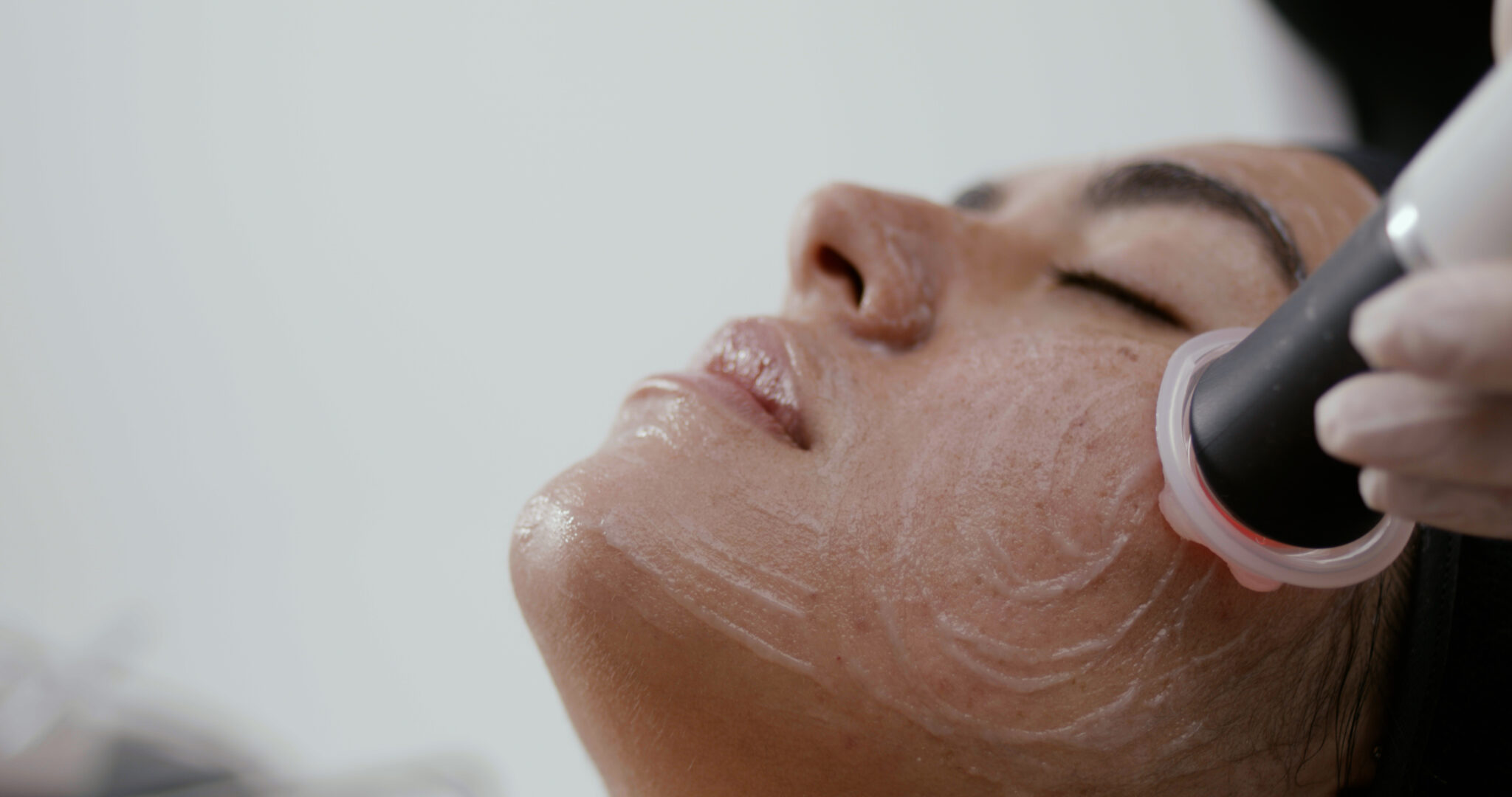 Glo2 Facial | Skin Rejuvenation Clinic Skin Rejuvenation Clinic